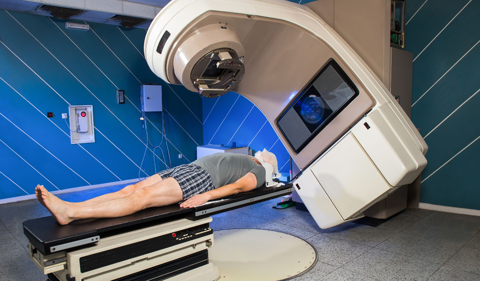 La radioterapia y los tumores secundarios